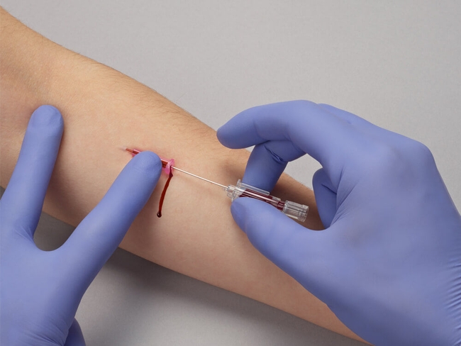 Blood Exposure: Risks and Prevention with PIVC | B. Braun Malaysia